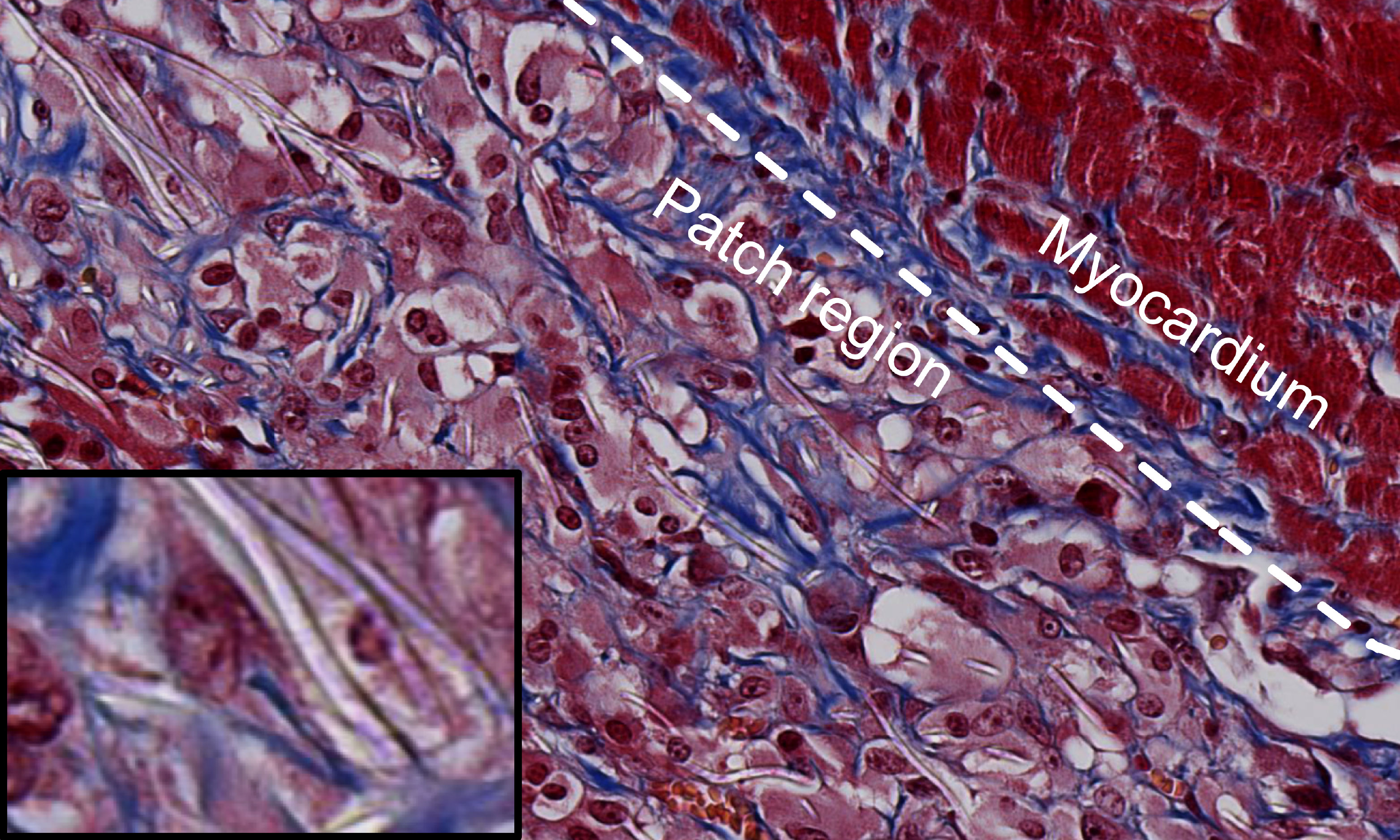 New technology uses heartbeats to heal the heart | CNC UC